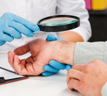 Skin Infections Treatment in Winter Park – Dermatology Clinic ...